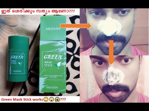 ഇതു ശെരിക്കും working ആണോ ?? |Viral Magical Green Stick in Malayalam| how to remove pimples and acne