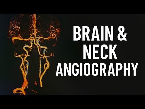 How to Perform Brain & Neck Angiography 🧠🫁 | Full Demo 🎬
