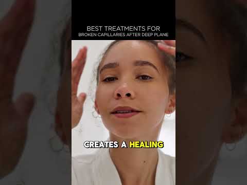 Best Treatments for Broken Capillaries after Deep Plane