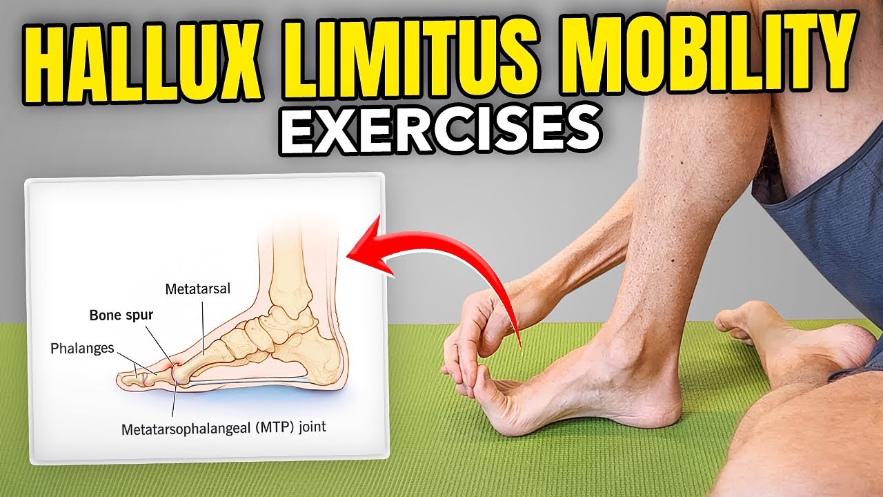 Big Toe Mobility Exercises (Hallux Limitus)