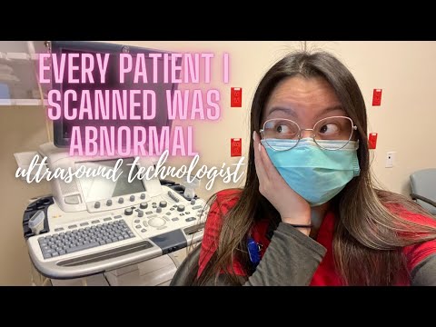 Sonographer explains ABNORMAL ultrasound scans | vascular, abdomen, & ob/gyn