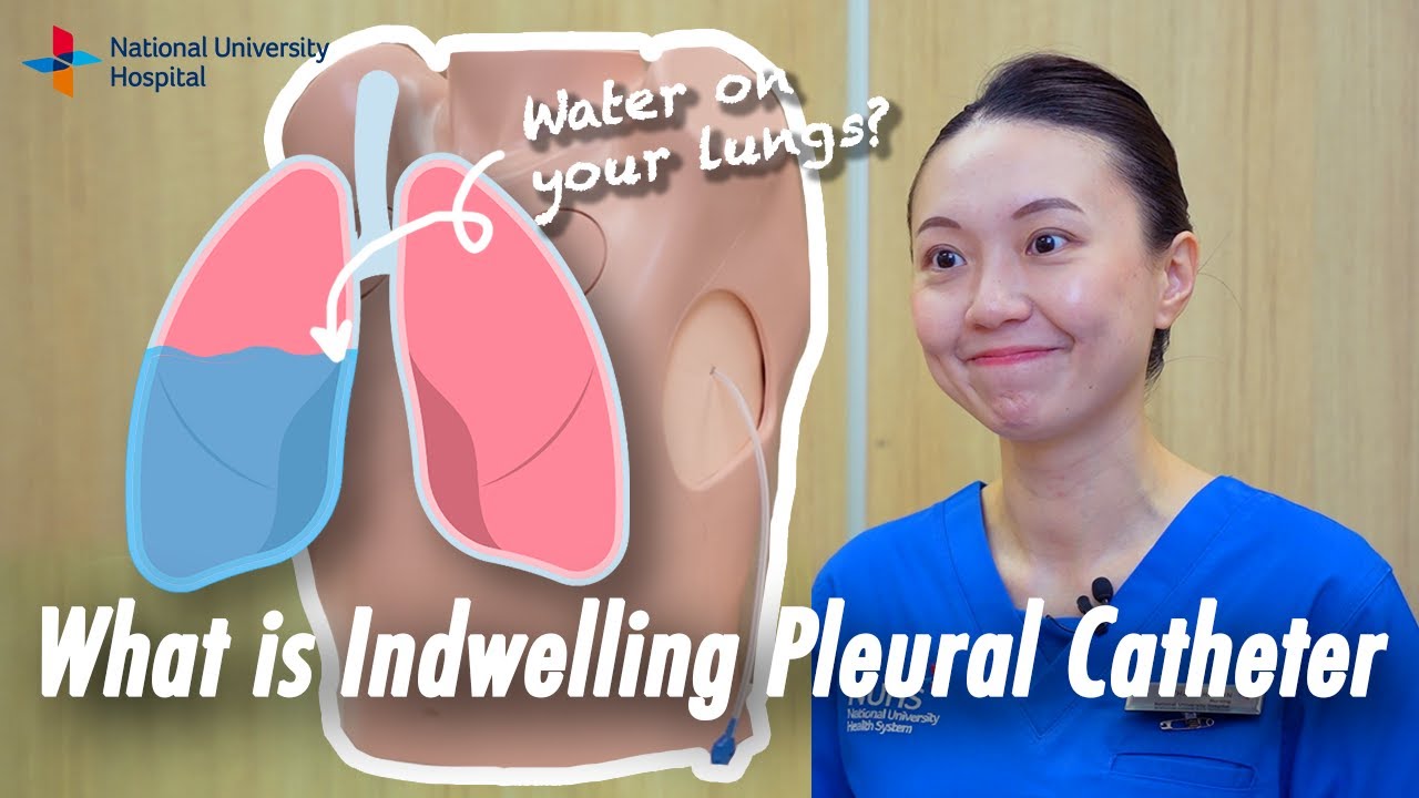 Living with an Indwelling Pleural Catheter (IPC): Complete Guide to Showering & Daily Care