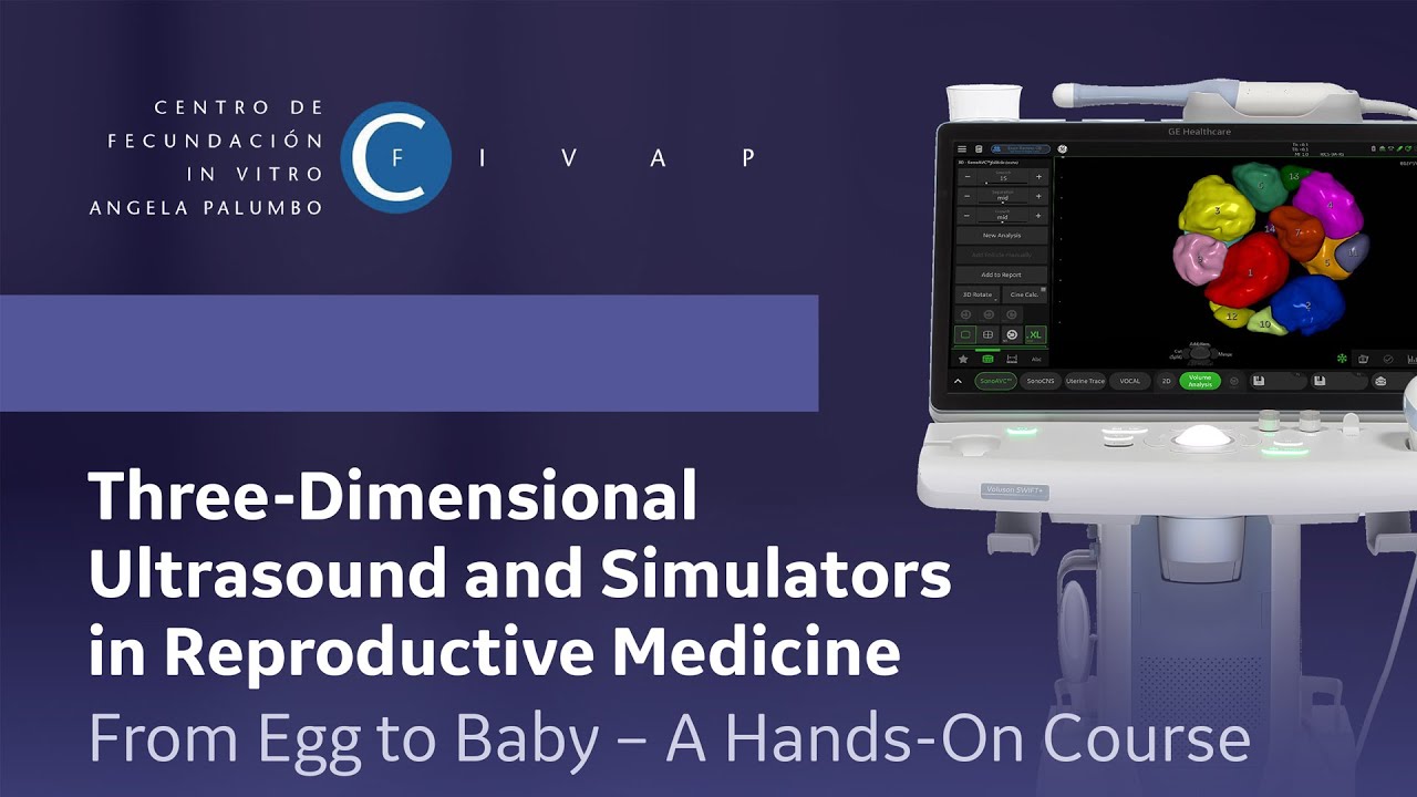 Automatic Evaluation of Ovarian Follicles at Baseline and During Stimulation