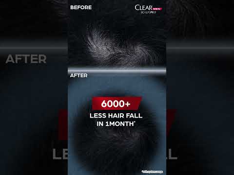 New Clear Men Scalp Pro Anti-Hairfall Fortifying 15s