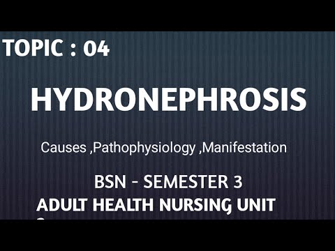 Hydronephrosis in urdu/hindi - hydroureter in Urdu
