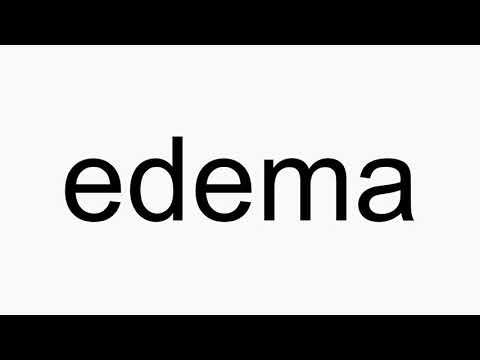 How to pronounce edema