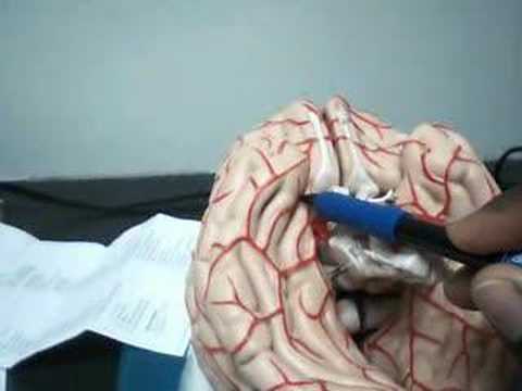 Rhinal sulcus and Occipitotemporal gyrus