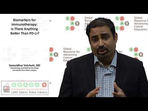 Velcheti Biomarkers for Immunotherapy Is There Anything Better Than PDL1