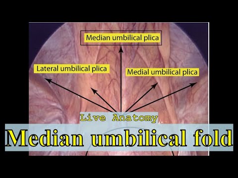 Medial Umbilical Ligament Cadaver