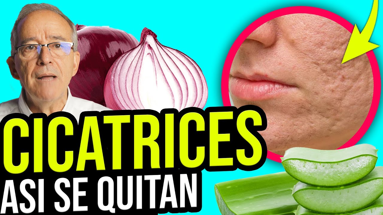 CÓMO QUITAR Las CICATRICES ? - Oswaldo Restrepo RSC