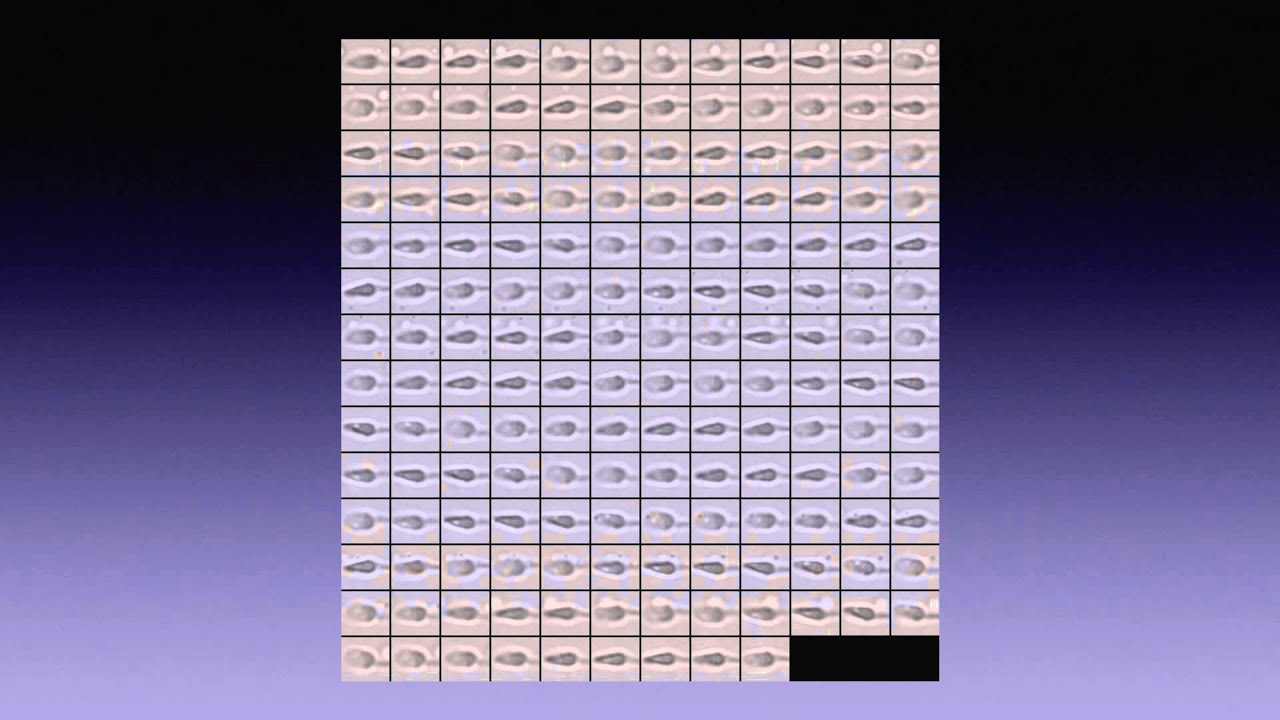 3D Sperm Surface Reconstruction- A Novel Three-Dimensional Approach to Assessing Sperm Morphology