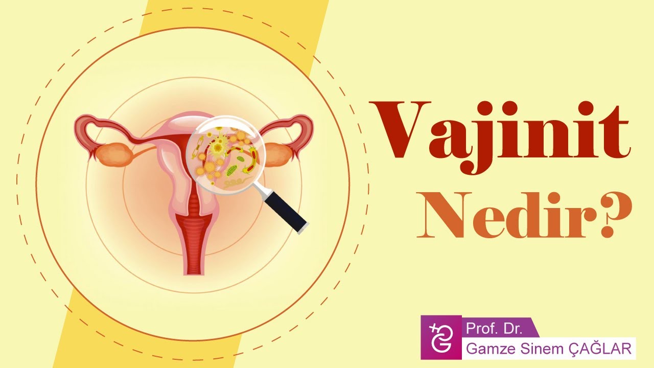 What is Vaginitis, What are its Symptoms and How is it Treated - Prof. Dr. Gamze Sinem
