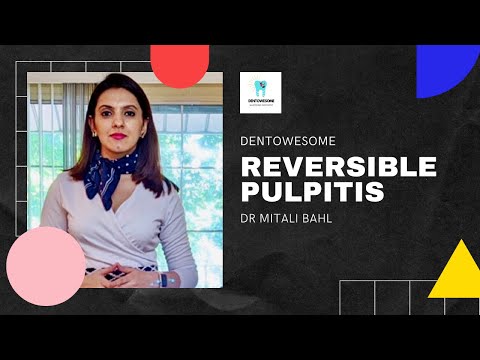 REVERSIBLE PULPITIS | PULP INFLAMMMATION | ENDODONTICS