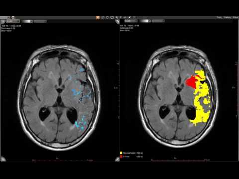 Olea Nova Move - Dynamic temporal information of blood flow