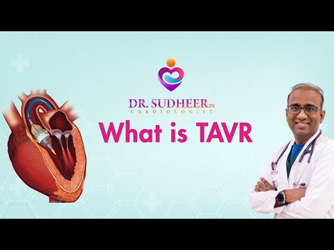 What is TAVR ? Dr Sudheer Koganti | Best Cardiologist in Hyderabad