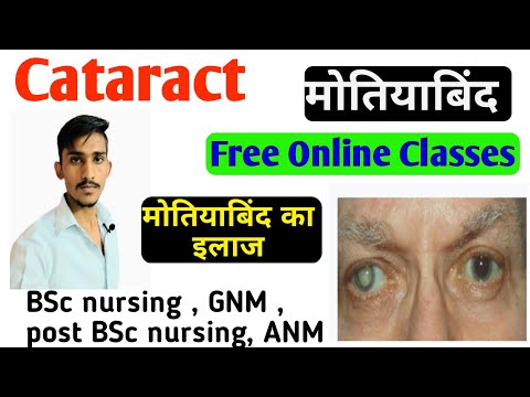 Cataract | मोतियाबिंद | cataract in hindi | मोतियाबिंद का इलाज | lecture on cataract |