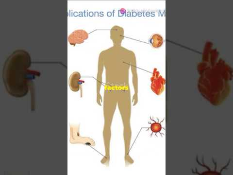Quick Guide to Balanitis! #balanitis #urology #surgeryday #medicalshorts #medstudentlife #doctor