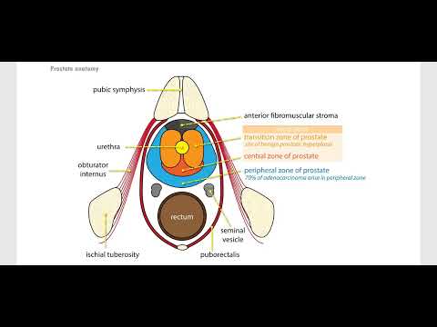 Genitourinary imaging from core radiology images onlyㅣradiopaedia@RadiologyChannel @ctisus