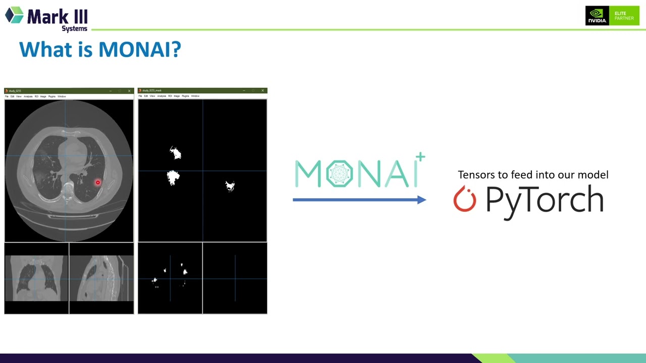 MONAI:  What is it and how is it accelerating the adoption of AI in Medical Imaging?