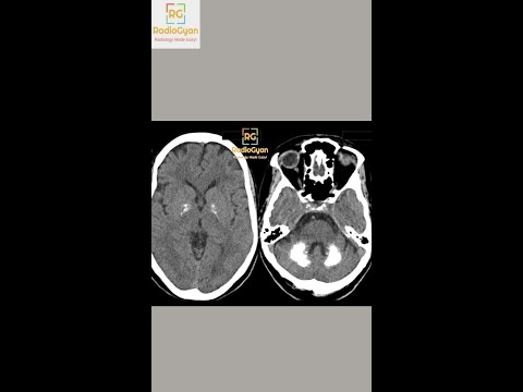 What is your diagnosis for this case? #Shorts