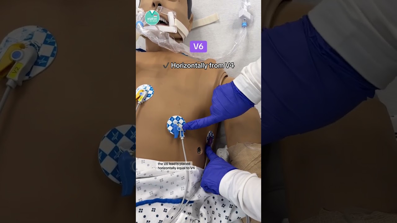 12-Lead EKG Placement