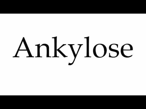How to Pronounce Ankylose
