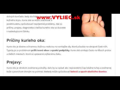 Kurie oko