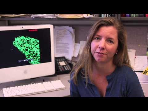 Endosome DividER