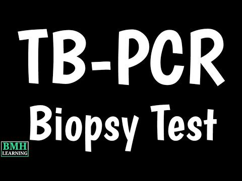 TB PCR Test | TB Biopsy Test | TB Gold Test |