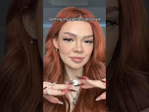 getting my lip fillers dissolved โจ