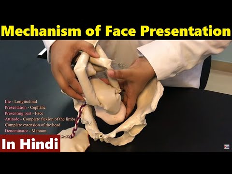 Mechanism of Face Presentation in Hindi | Practical Explanation of Malpresentation | Nursing Lecture