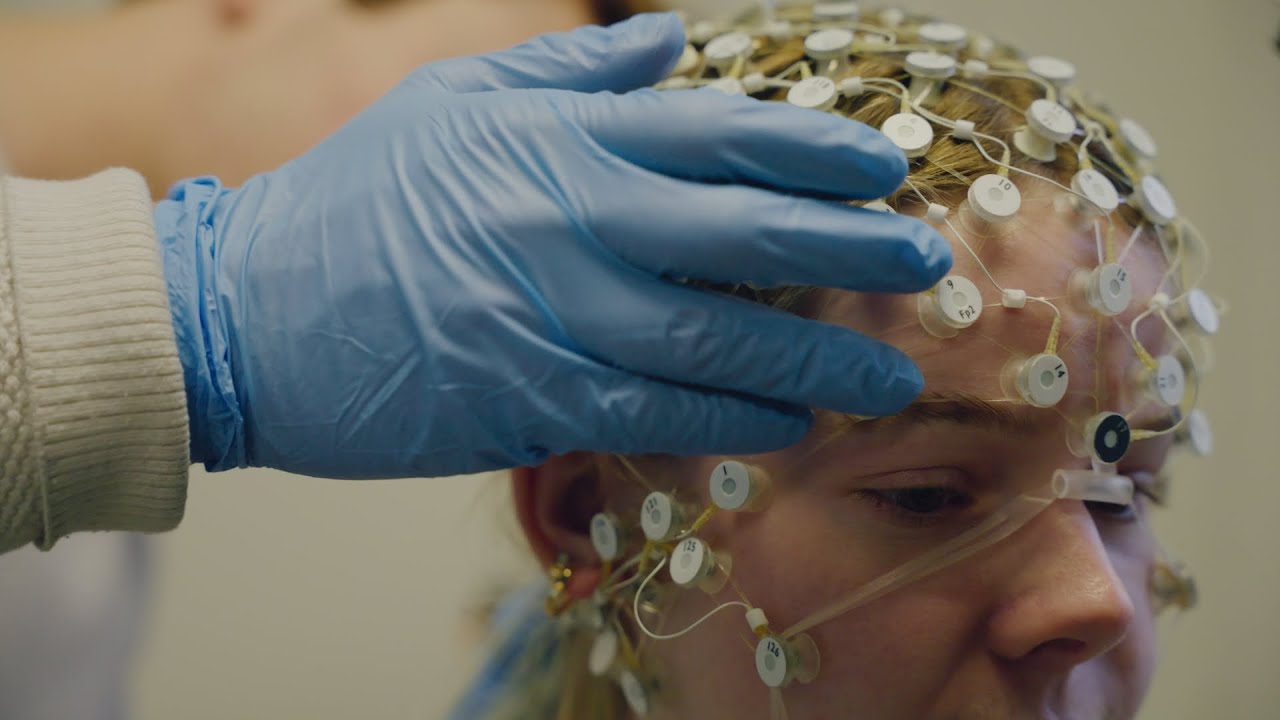 Advancing Brain Research: The Frohlich Lab's Work in Neurostimulation and Mental Health