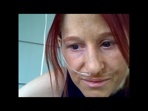 New Study: Pro-Ana Sites *HELP* Anorexics & Those w/ Other Eating Disorders?!