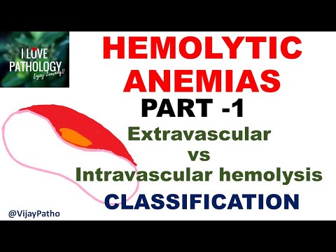 Hemolytic Anemias- Part 1: Definition, Extravascular Vs Intravascular hemolysis, Classification.