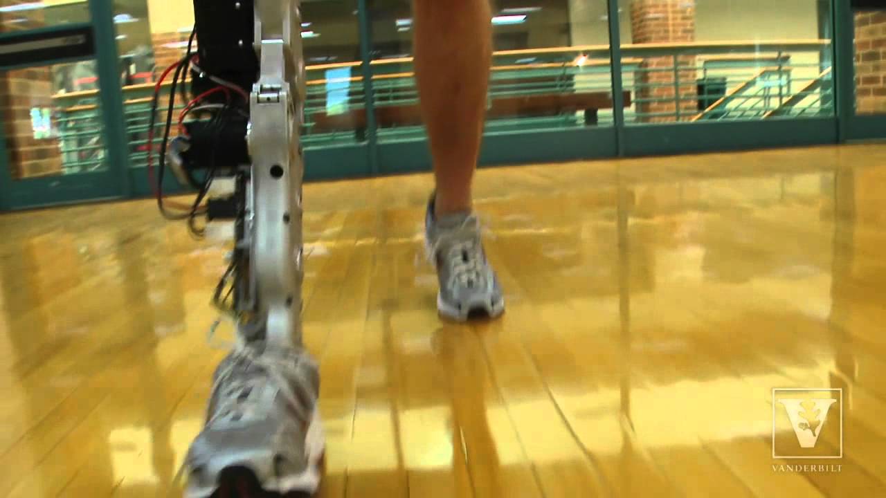 A.I. and the artificial leg - element14 Community