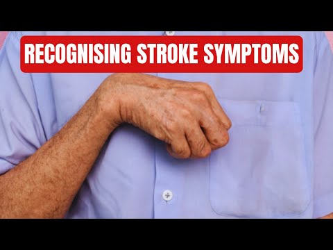 How To Tell If You Had A Stroke or TIA (Minor Stroke) | Stroke Symptoms & Signs
