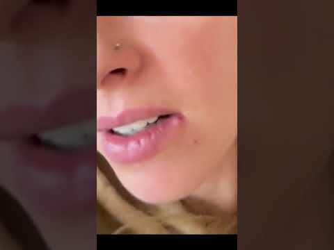 Blackhead King, Week in Review 2