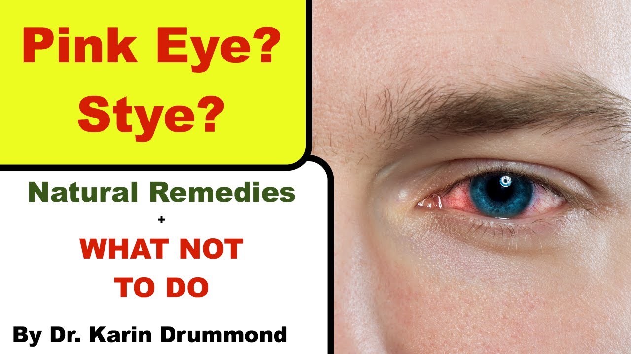 Stye Treatment Home Remedy