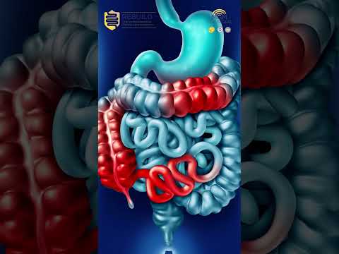 Problem Related To Hernia | Minimal Invasive Surgery | Rebuild Hernia
