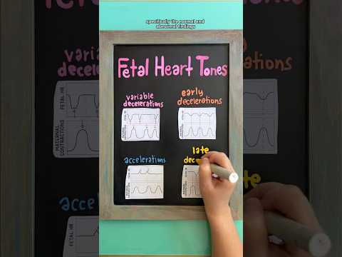 FETAL HEART TONES Nursing Student Review #nursingschool
