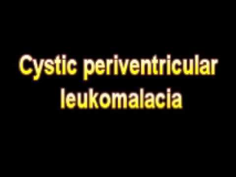 What Is The Definition Of Cystic periventricular leukomalacia - Medical Dictionary Free Online