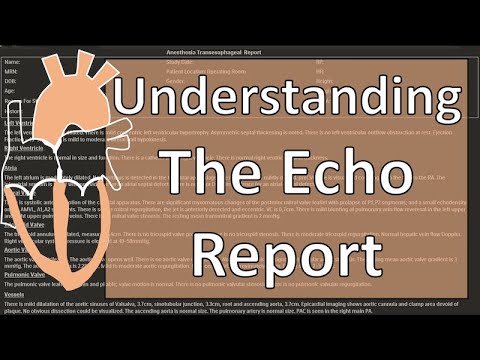 Why do I need an Echo? Explaining and Understanding the Echocardiogram and Report