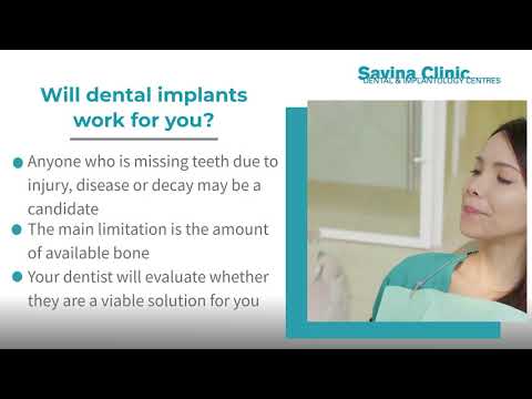 Dental Implants Frequently Asked Questions - Savina Dental Clinics (Malta & Gozo)
