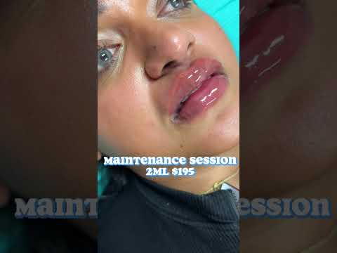 Income as a Hyaluron Pen Tech in Houston