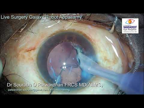 Appasamy Robot Live surgery from Nandadeep Eye Hospital Dr Sourabh Patwardhan