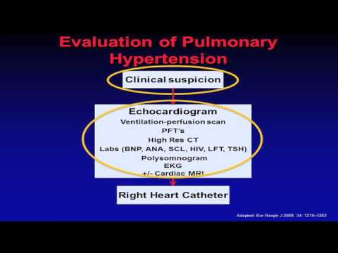 : Evaluation of a Patient Suspected to Have Pulmonary Hypertension