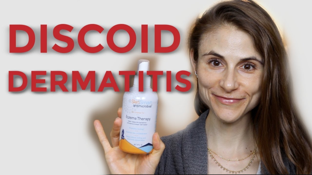 DISCOID (NUMMULAR) DERMATITIS: TIPS FROM A DERMATOLOGIST| DR DRAY