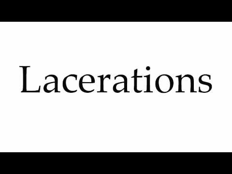 How to Pronounce Lacerations