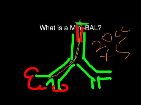 What is a Mini BAL (Bronchoalveolar Lavage)