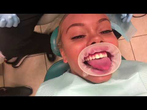 GOT A BAG & FIXED MY TEETH! (MIAMI VLOG)